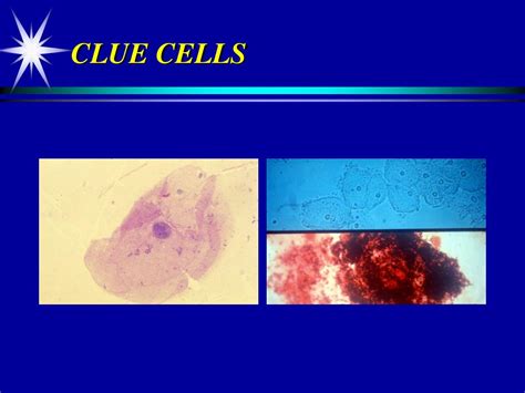 Ppt Diagnosis And Treatment Of Vaginitis Powerpoint Presentation