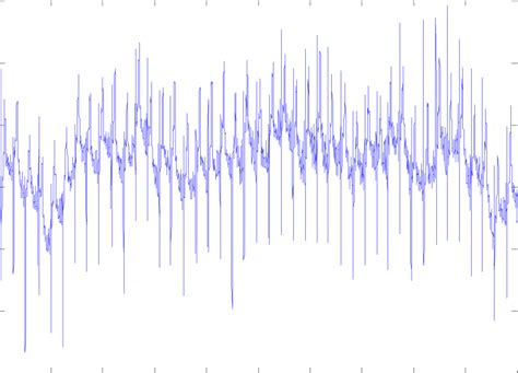 Ecg Signal Contaminated By A Mixture Of Different Noise Sources Download Scientific Diagram