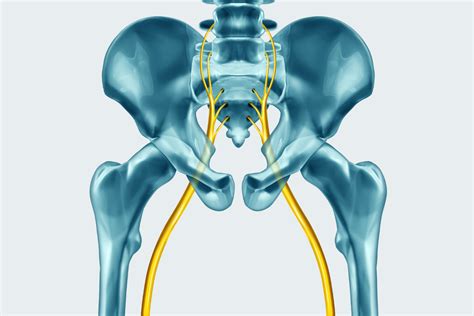 All About Sciatica From A Herniated Disc Advanced Ortho And Spine