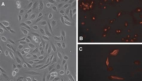 Glomerular Endothelial Cells