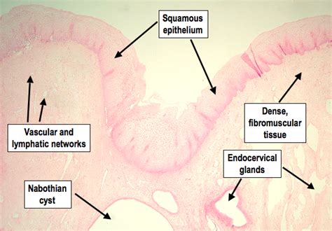 Histoquarterly Cervix Histology Blog