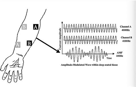 Use Of Tens Guidelines La Vaca Cega Desconfiada