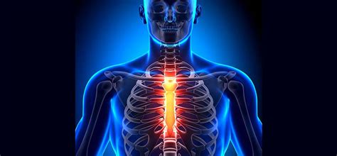 Dolor En El Esternón Por Osteocondritis Fisioterapia Talavera Martín