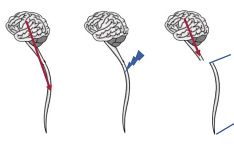 Spinal Cord And Motor Control Flashcards Quizlet