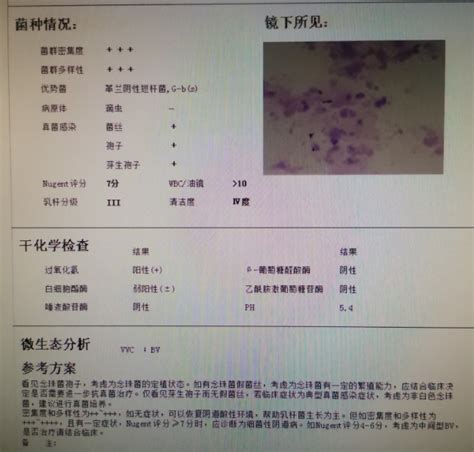 怎么解读阴道分泌物白带常规报告单 知乎