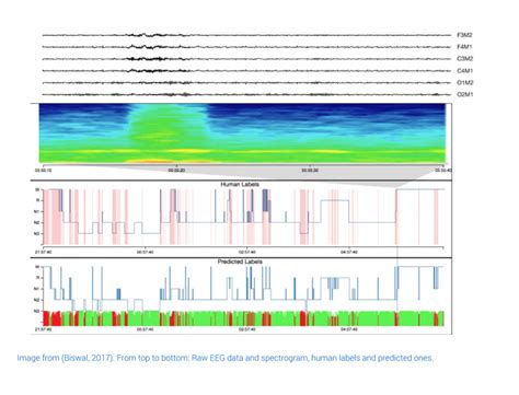 Ai For Eeg Data Processing Deep Learning Bitbrain
