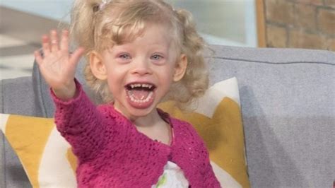 About Williams Syndrome