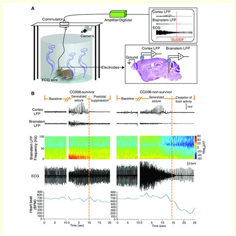 Distinct Brain And Heart Activities During Ictal And Postictal Phases Download Scientific