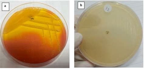 Conventional Identification Of Methicillin Resistant Staphylococcus Download Scientific Diagram