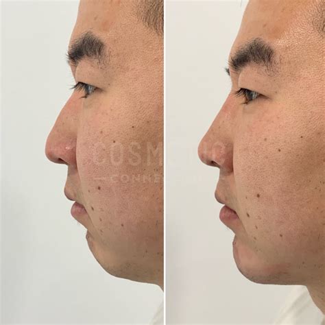 Flat Face Profile 75 066 Serious Face Of Man Middle Eastern Profile