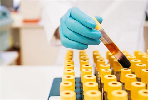 Lab Testing A Complete Guide To The Process Speed Cap