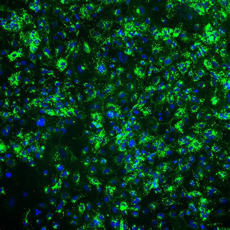 Immortalized Human Umbilical Vein Endothelial Cells Huvec Cells Online