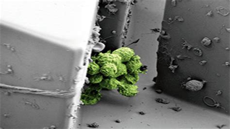 Microchip Can Capture Circulating Tumour Cells