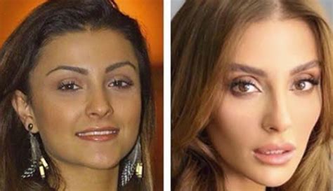 مدل و بازیگر مشهور ترک کوبیده از نو ساخته اما ادعا می‌کند فقط دماغش را عمل کرده؛ شما قضاوت کنید