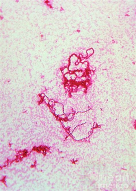 Streptococcus Pyogenes Chains In Pus Greeting Card By John Burbidge