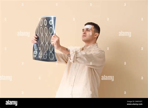 Young Man With Brain Concussion And Mri Scan On Beige Background Stock