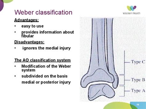 Ankle Fractures Phong Tran Orthopaedic Surgeon Western Health