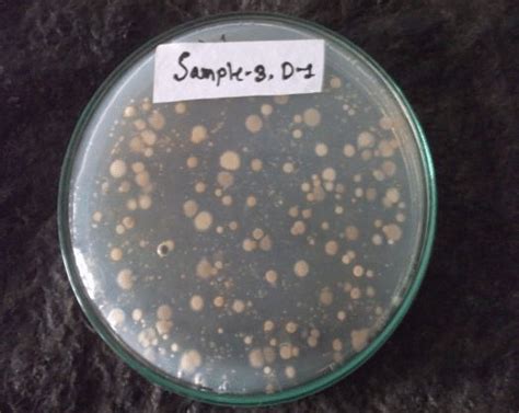 Colonies Of Actinomycetes Appeared On The Dilution Plates Using The