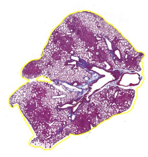 How To Export Tiles Of Large Histology Images In Qupath Carpenter Singh Lab