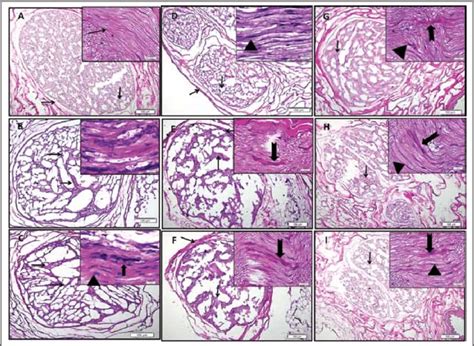 Cross Sections And Longitudinal Inserts Of The Ipsilateral Sciatic