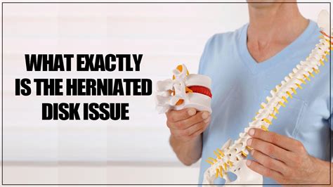 How Physical Therapists Assist In Treating Herniated Disk Lawtonphysicaltherapy