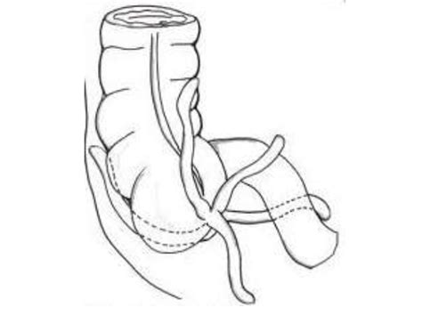 Appendix Drawing At GetDrawings Free Download