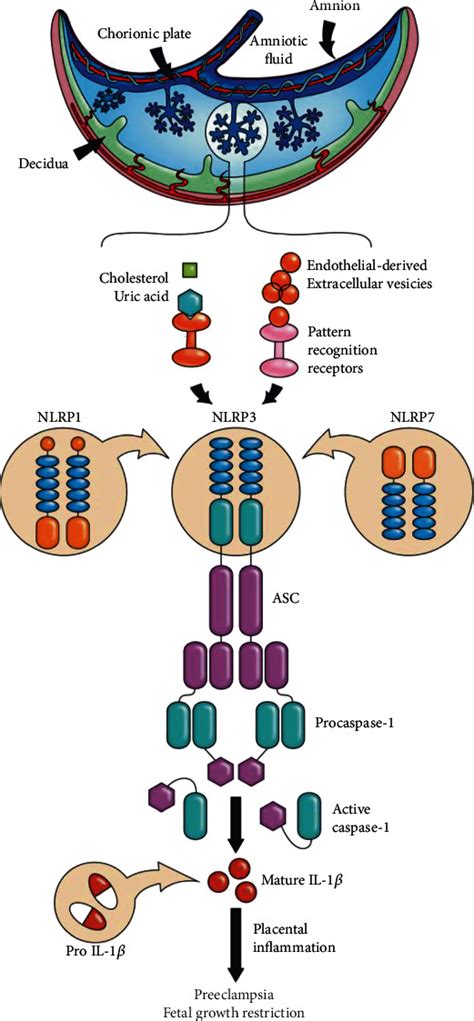 The Role Of Inflammation In The Pathogenesis Of Preeclampsia Pmc