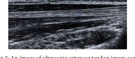 Figure 2 From Motion Estimation Using The Firefly Algorithm In Ultrasonic Image Sequence Of Soft