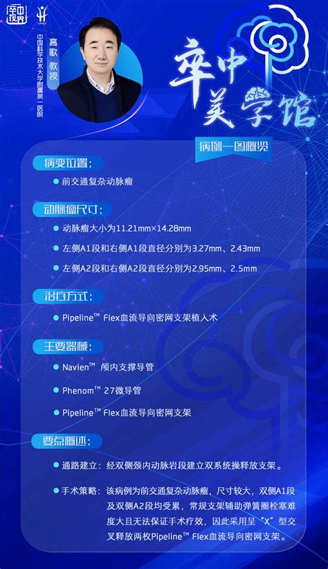 高歌教授：交叉释放 化繁为简 Pipeline Flex血流导向密网支架治疗前交通复杂动脉瘤 手术 导管 难度