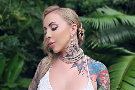 I M Home Safe Rhodurban Star Jojo Robinson After Surgery