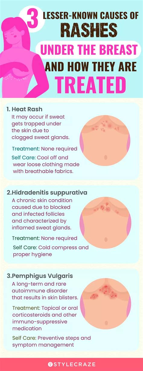 Rash Under Breast Heat Yeast Infection Itching Hidradenitis