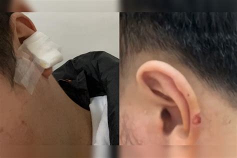 男子理发时耳朵被剪掉肉！理发店只付200元，反怼男子漫天要价