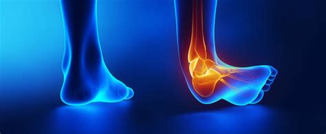 Ouch Gordon Haywards Dislocated Ankle And Fractured Tibia