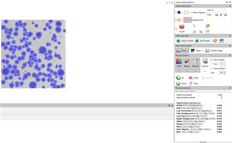 Smart Segmentation Issue Media Cybernetics Image Analysis Forums