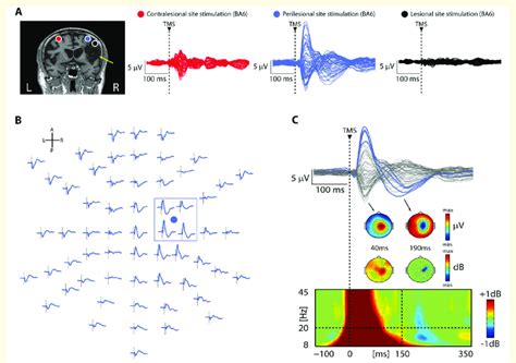 Tms Reveals Local Sleep Like Slow Waves Associated With Cortical Download Scientific Diagram