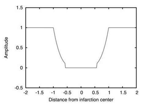 Figure 3 From Reconstruction Of Myocardial Infarction Using The Improved Spatio Temporal Map