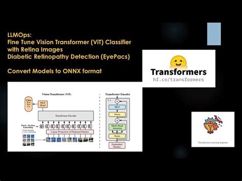 Free Video Fine Tuning Vit Classifier For Retina Images And Converting To Onnx Format Part 3