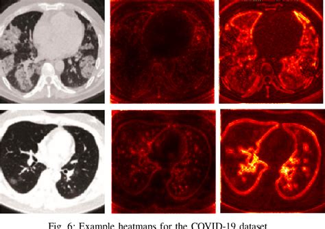 Figure 6 From M Rule An Enhanced Deep Taylor Decomposition For Multi Model Interpretability
