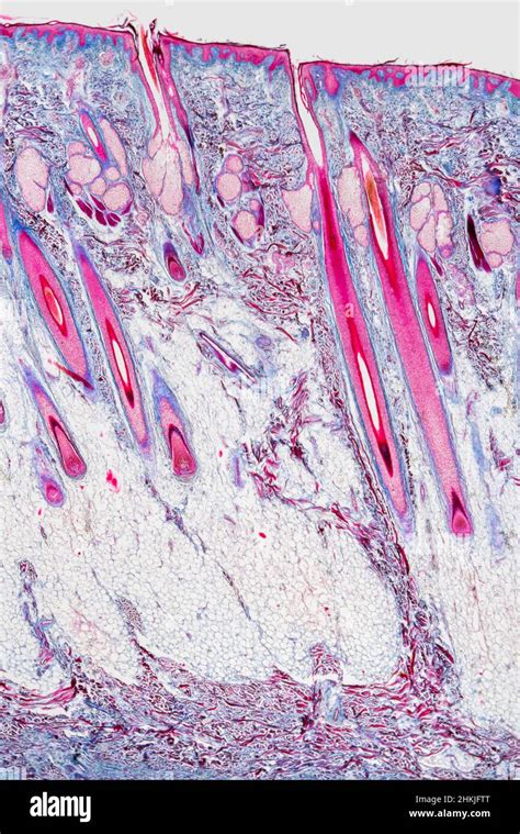 Human Scalp Light Micrograph Stock Photo Alamy