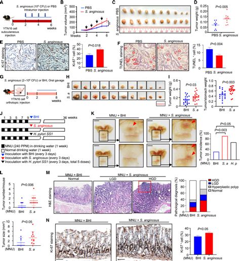 Streptococcus Anginosus Promotes Gastric Inflammation Atrophy And