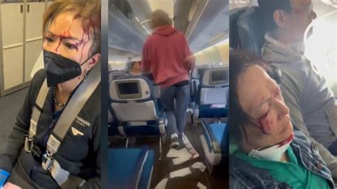 Severe Turbulence Injuries 36 Passengers On Hawaiian Flight Inside
