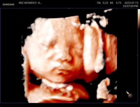 임신일기 임산부 일상 기록임신 중기~후기 초음파 앨범 태교여행 만삭사진 입체 초음파 네이버 블로그