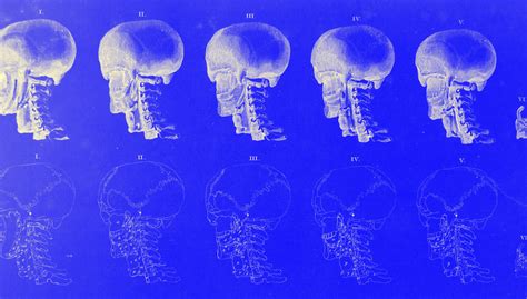 Choosing Between Umbraco And Wordpress Adtelic