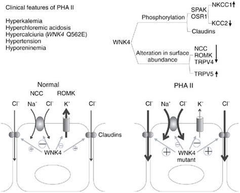 Connection Between Clinical Manifestation Of Pseudohypoaldosteronism Download Scientific