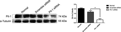 Phosphonoformic Acid Reduces Hyperphosphatemia Induced Vascular