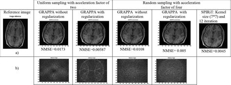 optimizing magnetic resonance imaging reconstructions