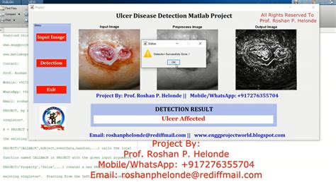 Ulcer Detection Using Image Processing Matlab Project With Source Code