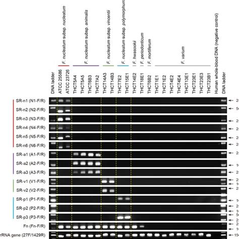Fusobacterium Nucleatum Subspecies Detection In Tumour Tissues From Download Scientific Diagram