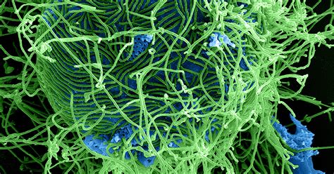 Mrc Brain Network Dynamics Unit Ukri