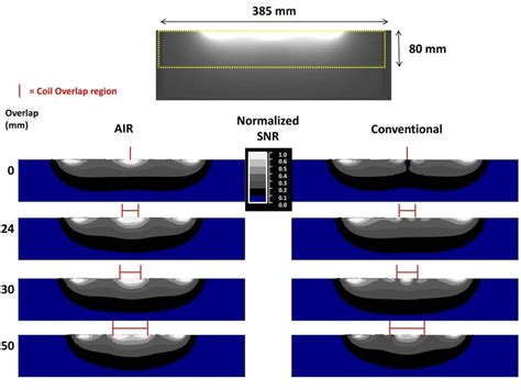 Normalized Signal To Noise Ratio SNR Plots As A Function Of Coil Download Scientific Diagram